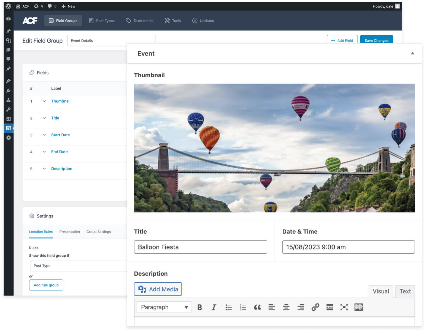 Advanced Custom Fields (ACF) สุดยอดปลั๊กอินจัดการเนื้อหาที่ทุกคนควรมี ... Advanced Custom Fields (ACF) สุดยอดปลั๊กอินจัดการเนื้อหาที่ทุกคนควรมี ...